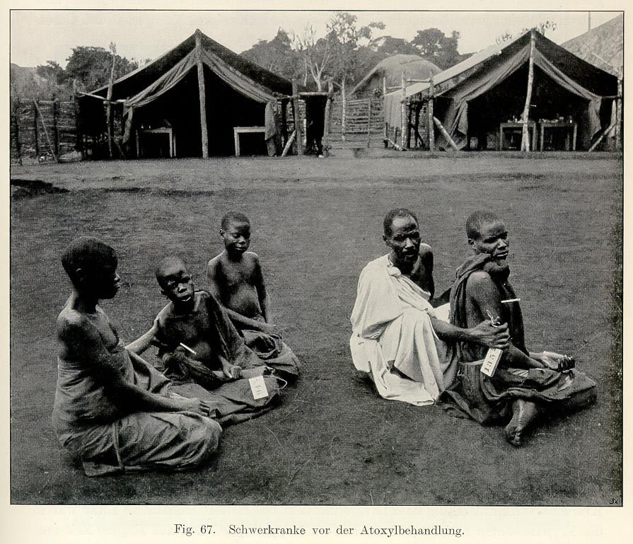 Maladie du sommeil - Société Francophone de Médecine Tropicale et Santé ...